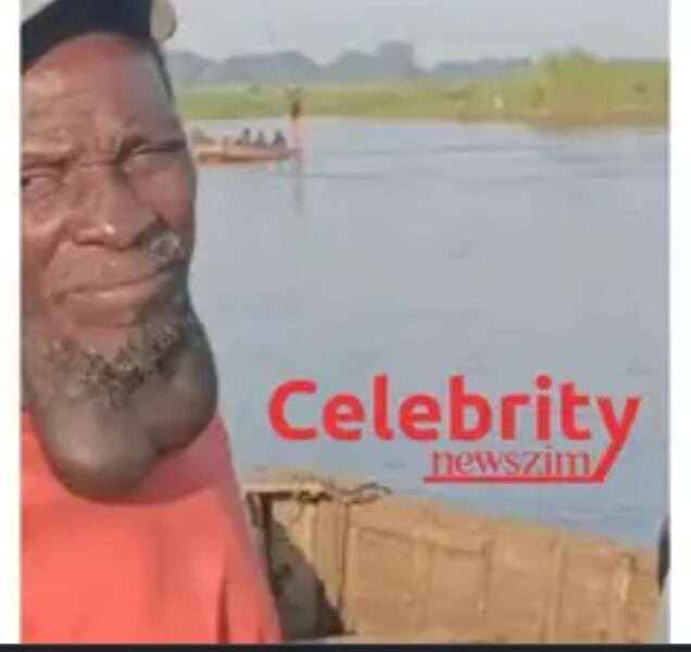 Chipinge Headman Develops 'Balls' on His Face | Zim Trending